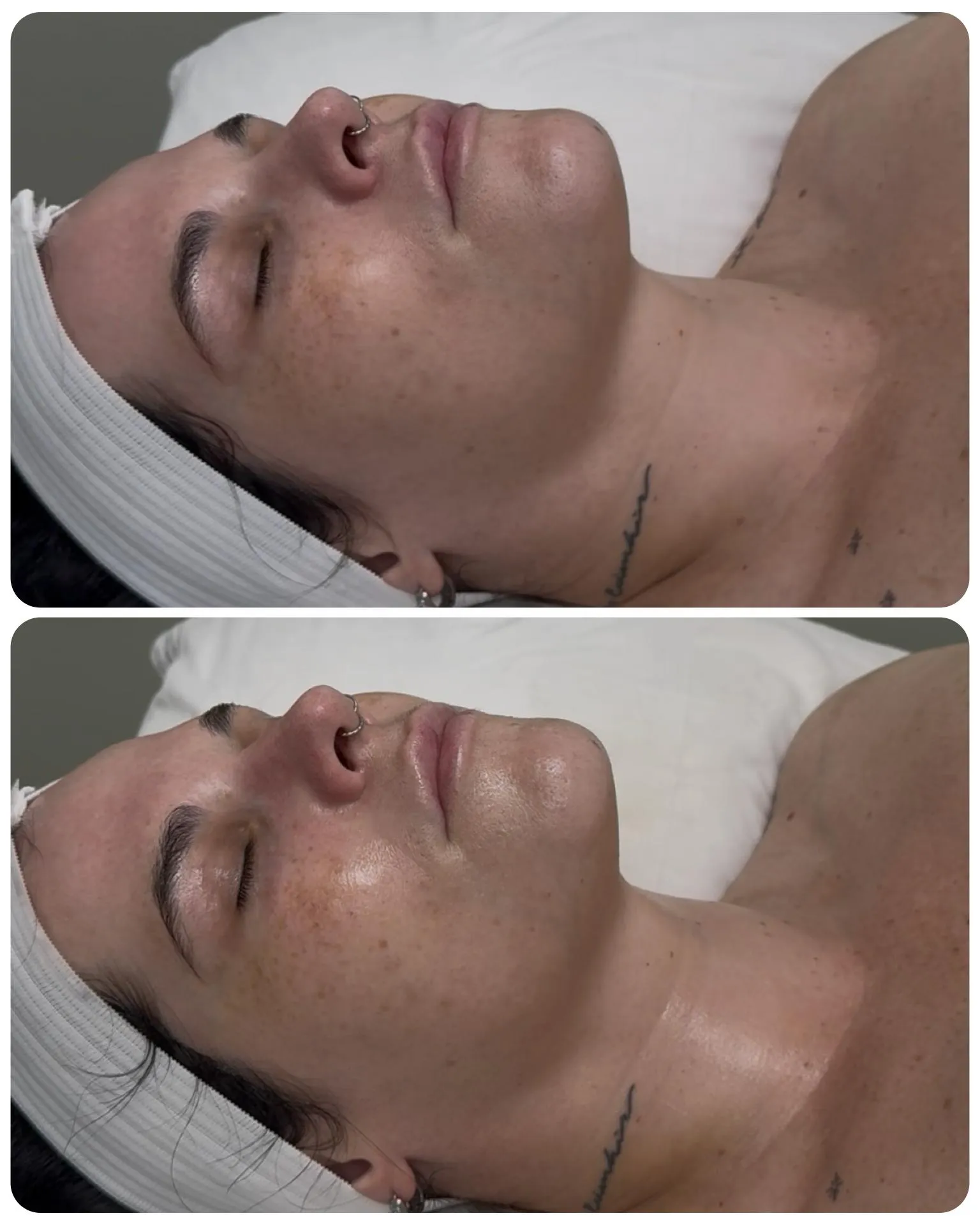 Skin Integrity Facial in Burbank, California